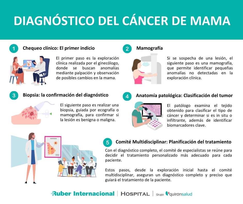 Diagnóstico y Tratamiento del Cáncer de Mama